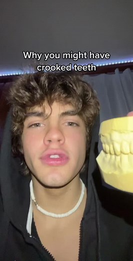 Understanding Crooked Teeth: Causes and Solutions