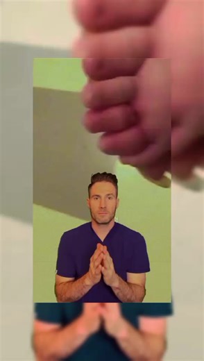 A hair tourniquet occurs when a strand of hair becomes tightly wrapped around an extremity, such as a finger or toe, or around genitalia, leading to circulatory compromise and potential tissue necrosis. It is most commonly seen in infants and young children with long-haired caregivers. Prompt recognition and removal of the hair are crucial for preventing complications like infection or loss of the affected appendage. Surgical intervention may be necessary if the hair is tightly embedded. Vid @Ti