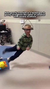 7.9K views · 80 shares | Kid Uses a medical device named Halo Gravity Traction that's used to treat Scoliosis (Spinal Deformity) The use of Halo-Gravity Traction removes the impact of gravity on the spine deformity, elongating the spine and stretching out surrounding soft tissue. #halo #gravity #traction #scoliosis #spinal #deformity #deformitycorrection | Pinky Health | Facebook