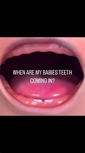 baby care on Instagram: "✨ When do teeth first come in? They can as early as 4ish months, but we don’t get concerned unless your baby has no teeth bu 15 months. If that’s the case, you should be seeing a pediatric dentist. 🪥 When do I brush my baby’s teeth? As soon as the first one sprouts! You can wash with a fluoride toothpaste the size of a grain of rice until they are 3 years old, then switch to pea sized amount. ❌ Despite what you may hear, there is nothing safe to give to your baby when t