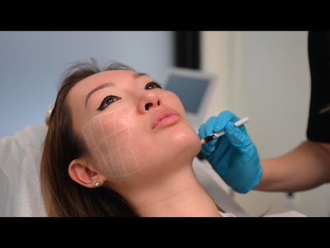 The Process of SkinVive Injectable Skin Booster Treatment by Juvederm