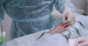 In surgery, the veterinarian sterilizes the pet using an endoscopic coagulator. Removal of a pet's uterus in veterinary surgery under anesthesia. Pet veterinary surgery concept.