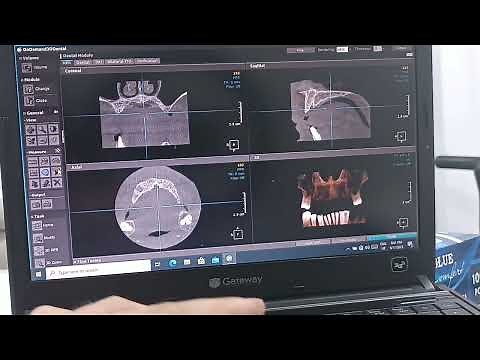 how to read CBCT | شرح طريقة قراءة اشعة ثلاثية الابعاد في طب الاسنان