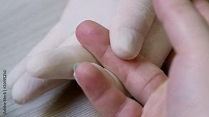 Close up of hands of unrecognizable nurse wiping finger of patient with antiseptic, then using lancing device to draw blood for glucose testing