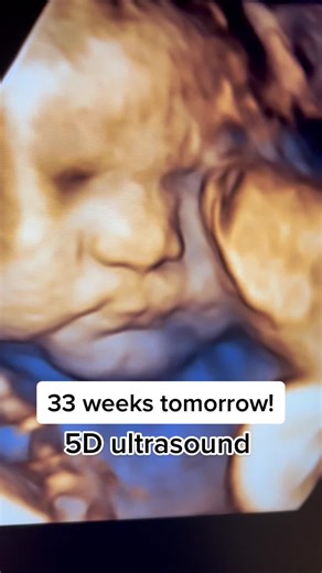 Incredible 5D Ultrasound at 33 Weeks of Pregnancy