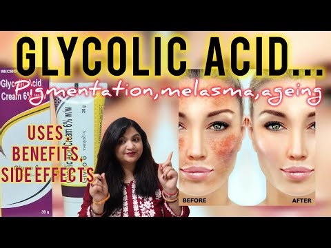 GLYCO 6 CREAM REVIEW GLYCOLIC ACID CREAM USES & SIDE EFFECTS #skincare #beauty #review #amazonfinds