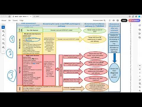 Quick review and tips for the new updated RCOG guideline: SGA and FGR (Green-top Guideline No. 31)