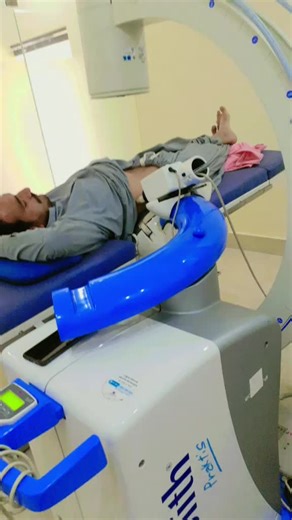 Understanding Kidney Stones and Lithotripsy Success