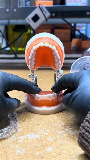 How should a retainer fit