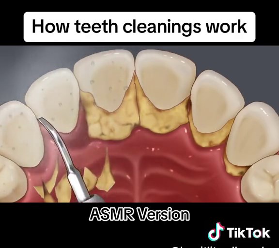 Dentist never tell you that…🤯 #howitworks #howitsmade #dentist #teeth