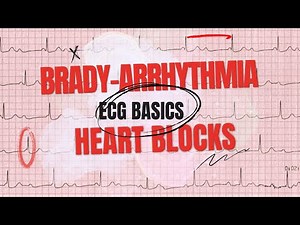 Heart blocks Explained | ECG basics -part 3 | SA blocks, AV nodal blocks, bundle branch blocks