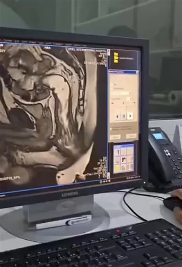 MR Defecography: A Non-Invasive Pelvic Floor Evaluation | Navid Abdolkarimi posted on the topic | LinkedIn