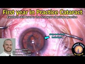 CataractCoach 1029: first year practice stop-and-chop cataract surgery