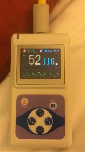 Never forget how low his o2 levels were before the fontan surgery. They went even lower than this too. #oxygen #o2 #sats #poorlyboy #chd | Reggie the half a heart warrior..day to day journey living with hlhs