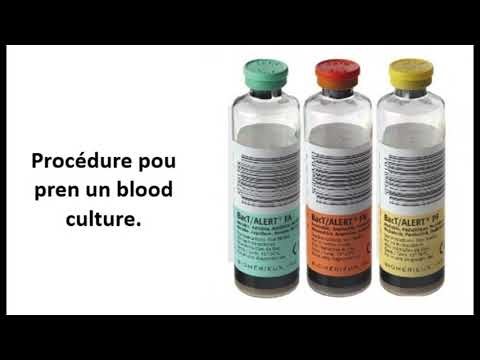 How to take blood cultures