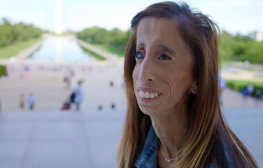 Story of woman called 'the ugliest in the world' by bullies