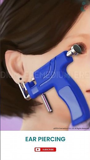 Process of Ear Piercing ↪ 3D Medical Animation #Shorts #EarPiercing #Ear