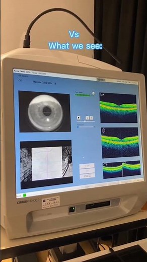 Optical Coherence Tomography ( OCT )1080p