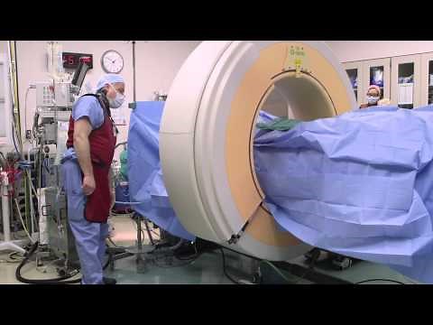 TriStar Skyline Surgeon Performs Spinal Fusion surgery with O-Arm