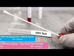 HPV DNA testing; detect high risk types of human papillomavirus