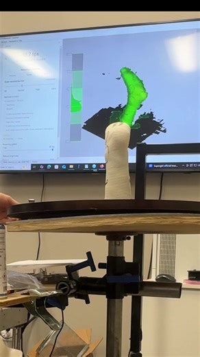 Digitalizing a foot cast for a SMO! #3dprinting #oandp #3dmodeling #prosthetics #CAD