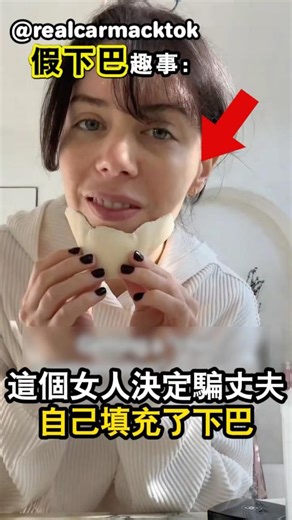 Her fake chin implants completely terrified her husband.