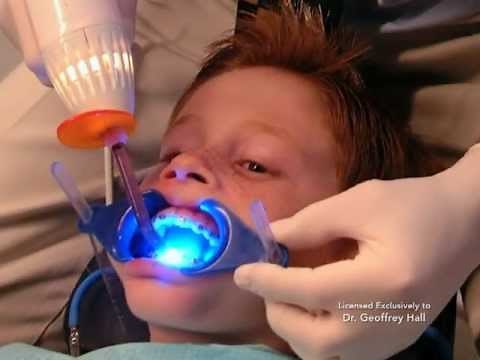 Fixed/Bonded Retainers at Advanced Orthodontics