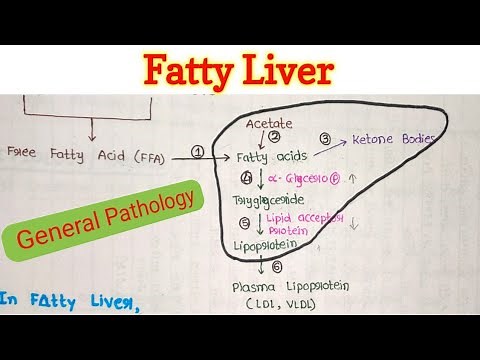 Fatty Liver / Steatosis of Liver / Fatty Change in Liver | General Pathology