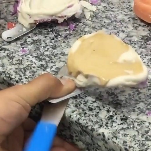 174K views · 1.8K reactions | Modern Engineering  #Dentistry #LearningTips #BitesnBraces #smile #medical #People #dentista #Tooth #Implant #Dental #dentist | Bites & Braces Dental | Facebook