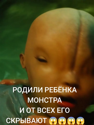 РОДИЛИ РЕБЁНКА МОНСТРА И ОТ ВСЕХ ЕГО СКРЫВАЮТ 😱😱😱😱Поставь пожалуйста лайк и подпишись чтобы не потерять ❤️ #сериалы #фильмы #фильм