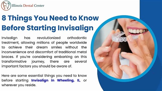 8 Things You Need to Know  Before Starting Invisalign