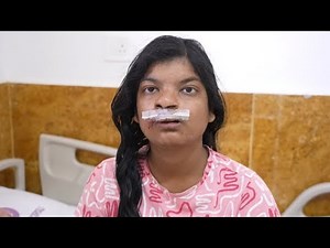 Bilateral Cleft Lip Surgery Explained | Before & After Results