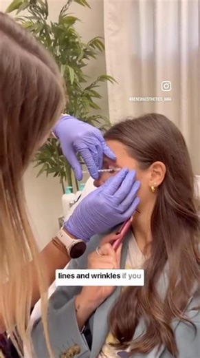 Erase signs of aging! Similar to Botox, Jeuveau temporarily paralyze facial muscles making lines.