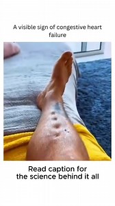 74K views · 267 reactions | This simple bedside test can reveal a...