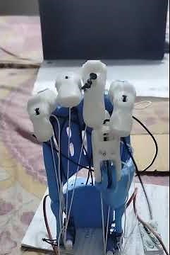 DIY 3D Printed Prosthetic Hand | Freely Moving Fingers in Action!".#3d printed project #mechanical👍👍