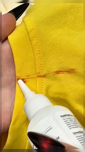 Fabric Rust Stain Remover ✨ | Benta Serye PH