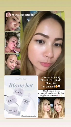 Blanc set by Beautederm ♥ | Beautéderm Shop by Kriza Marie - Santiago City, Isabela | Facebook