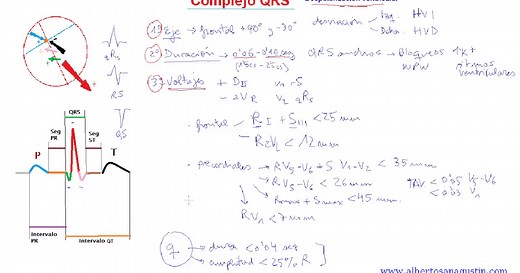 ECG normal (15): Complejo QRS