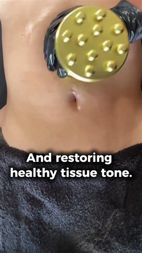 Body Contouring Explained: Lymphatic Flow, Fascia & Natural Tissue Support