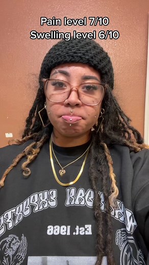 Dimple Piercing Healing Process: Days 1-12 | Cheek Piercings