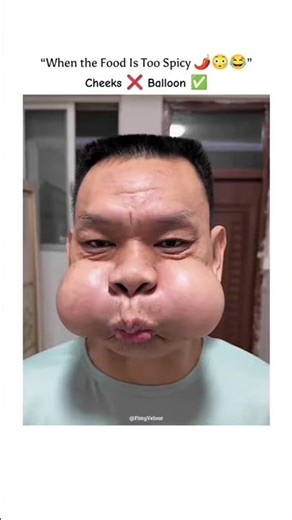 cheeks ❌ balloon ✅‼️ #entertainment #comedy #funny #fun #memes #comedyfilms #music
