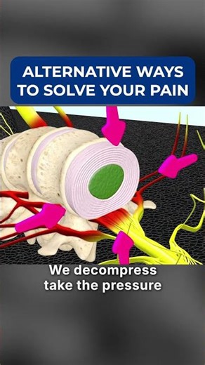Why Your MRI Doesn't Show Your Pain: The Truth About Spinal Decompression #BackPain #MRI