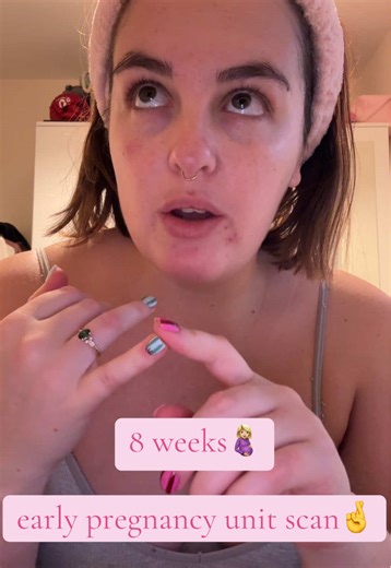 EPU Scan at 8 Weeks Pregnant Journey