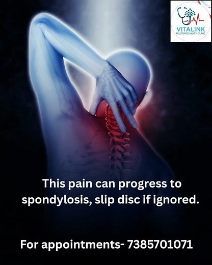 neck pain in desk job working professionals #neckpain #cervicalpain #spondylosis #orthopediccare
