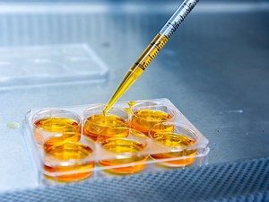 Biomedical Science Course with BSc (Hons) Degree | RGU University – Aberdeen, Scotland, UK | RGU