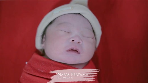 Setiap napas pertama adalah awal cinta tanpa akhir 🤍 Alhamdulillah, lahir dengan selamat melalui proses SC kerja sama @humanaprima x @nafaspertama . Terima kasih untuk doa, dukungan, dan cinta dari bunda dan ayah 💕 Momen berharga yang tak akan terlupa — awal perjalanan baru jadi keluarga kecil penuh cinta. 👶✨ ----- RS Humana Prima Jl. Rancabolang No.21 Telp : 022-7563701; 022-7563543; 022-7563489 ----- Sosial Media Kami :⁣⁣ Instagram : @humanaprima Tiktok : @rshumanaprima Website : humanaprim