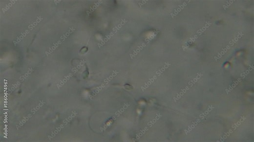 Microscopic view of moving human sperm cells with visible heads and flagella against a light background, commonly used in fertility and reproductive studies.