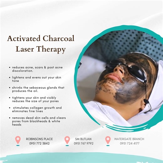 ACTIVATED CHARCOAL LASER THERAPY ✨ The state of the art skin treatment with instant visible results! Experience charcoal peel rejuvenation without the red post facial skin. 💟ACNE - This reduces acne, scars & post acne discoloration. Plus! Manages pimple outbreaks! 💟SUN SPOTS - This lightens and evens out your skin tone 💟OILY SKIN - This shrinks the sebaceous glands that produces the oil. 💟LARGE PORES - This tightens your skin and visibly reduces the size of your pores 💟SAGGY & WRINKLED - Th