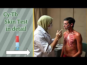 Cy-Tb skin test full informative detail video useful for all health care worker 🩻🏥💉 #cho #tb #anm