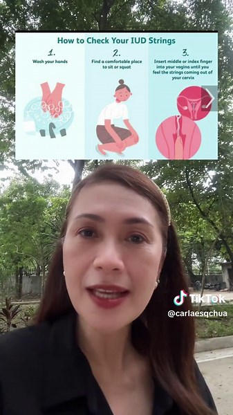 IUD Kailangan ba ng Nakalawit na String?